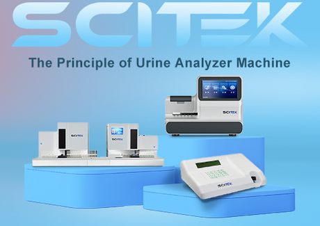 The Principle of Urine Analyzer Machine